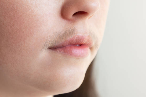 Empowering Girls: Facial Hair and Self-Expression