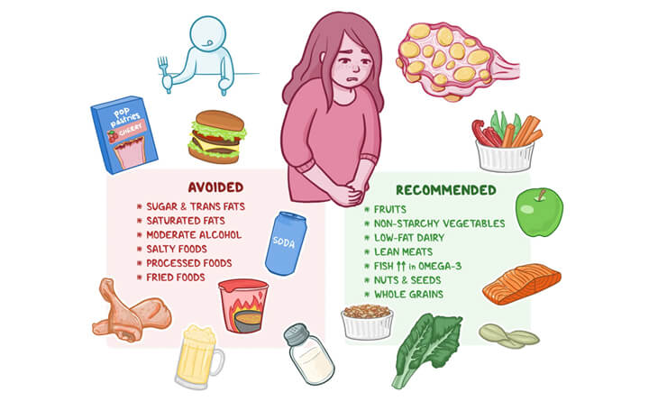 What is PCOS? (Diagnosis and Treatment) |Pressmaverick|