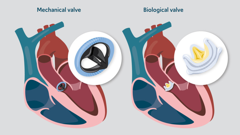 What to Know About Heart Valves - Pressmaverick
